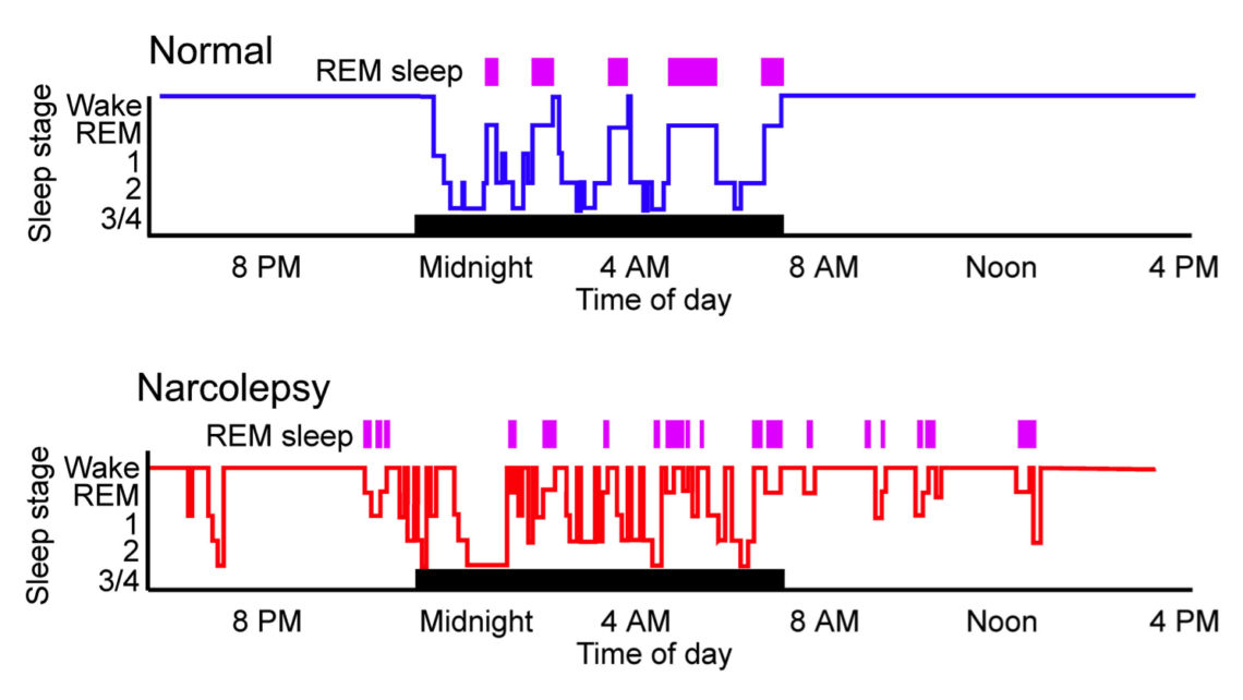 BIDMC – Neurology Fellowship: Sleep Disorders – BIDMC Neurology