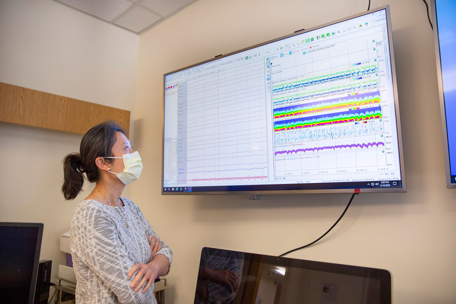 BIDMC – Neurology Fellowship: Adult EEG/Epilepsy – BIDMC Neurology